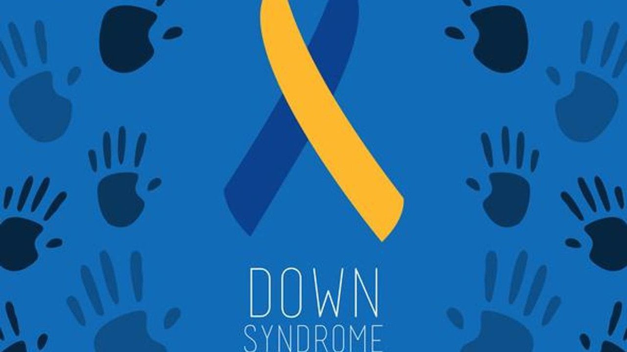 Down Sendromu Günü mesajları 2024 || 21 Mart Down Sendromu Fakındalık ... Down Sendromu Günü mesajları 2024 || 21 Mart Down Sendromu Fakındalık ...